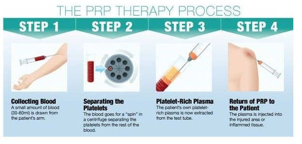 PRP THERAPY (PLATELET RICH PLASMA) - YOUnique Health & Wellness What ...